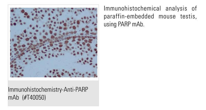 Total and cleaved PARP Antibody_经典一抗-