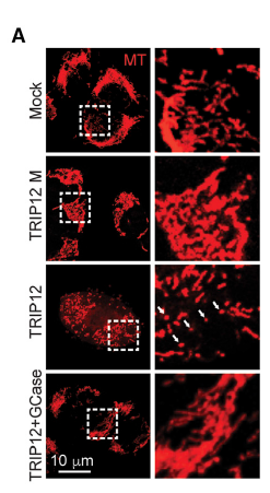 TRIP12 Antibody_经典一抗-