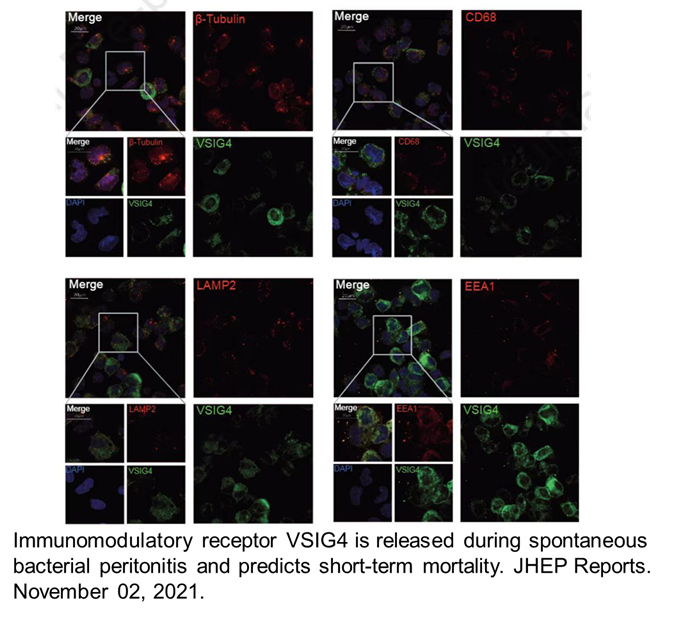 VSIG4 Antibody_经典一抗-