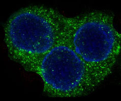 ROCK1 Antibody_经典一抗-