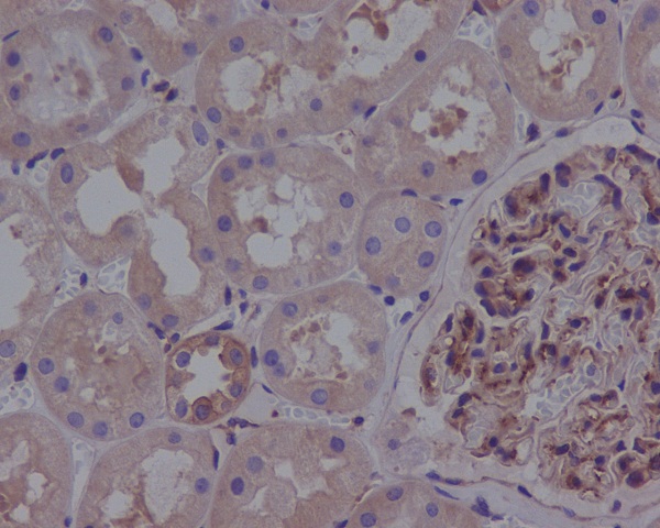 ROCK1 Antibody_经典一抗-