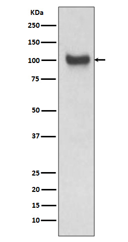 VCAM1 Antibody_经典一抗-