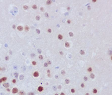Fos B Antibody_经典一抗-