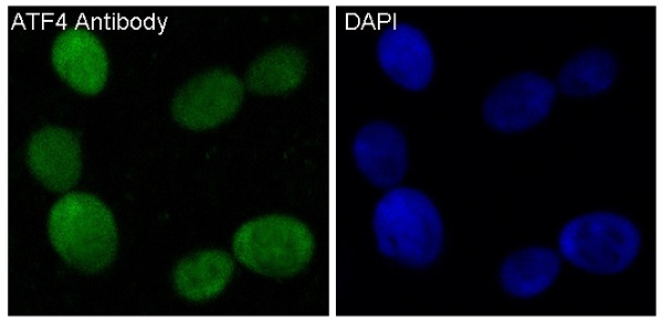 ATF4 Antibody_经典一抗-