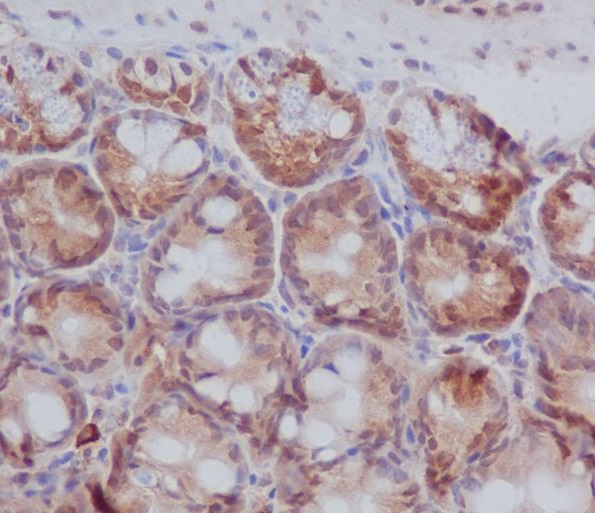 PKC beta 1 Antibody_经典一抗-