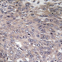 IP3R Antibody_经典一抗-