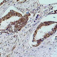 p21 Antibody_经典一抗-