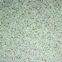 Ki67 Antibody_经典一抗-