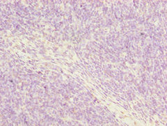 POSTN Antibody_经典一抗-