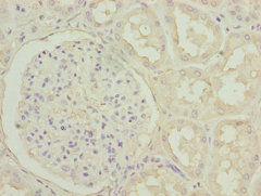 POSTN Antibody_经典一抗-