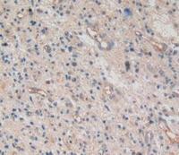AREG Antibody_经典一抗-