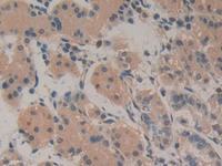 AREG Antibody_经典一抗-