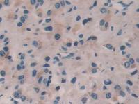 IL35 Antibody_经典一抗-