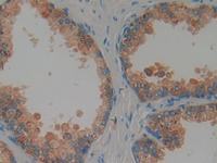 PRG4 Antibody_经典一抗-