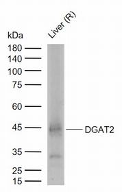 DGAT2 Rabbit pAb_经典一抗-
