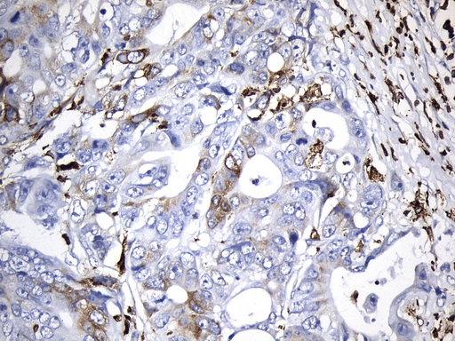 CD74 mouse monoclonal antibody_经典一抗-