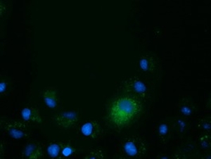 CD80 monoclonal antibody_经典一抗-
