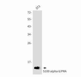 S100A6 antibody_经典一抗-