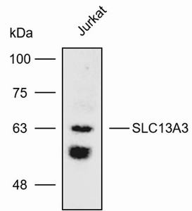 Anti-SLC13A3 Antibody_经典一抗-