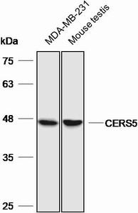 Anti-CERS5 Antibody_经典一抗-