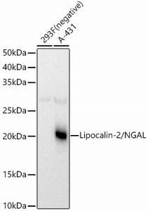 Anti-LCN2 Antibody_经典一抗-