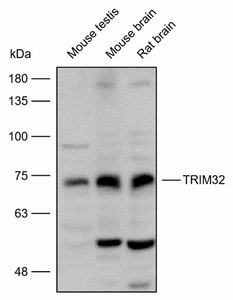 Anti-TRIM32 Antibody_经典一抗-